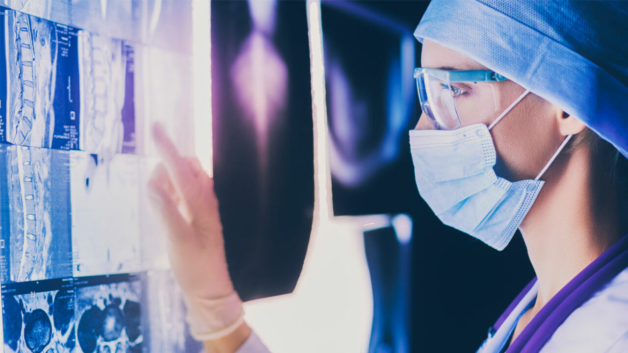 El papel de los radiólogos en diagnóstico por la imagen - Origen ...