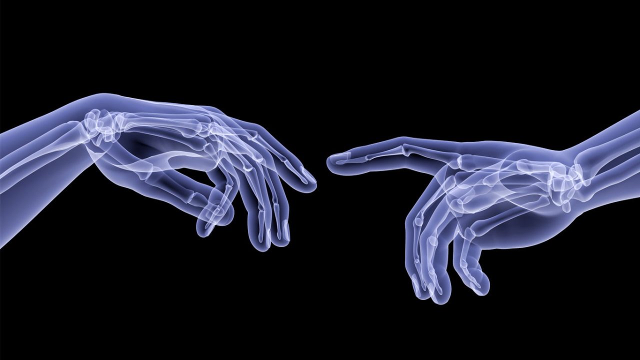 Osteogénesis Imperfecta: Huesos de Cristal - Origen, Diagnóstico y ...